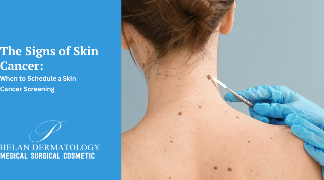 Blog - Phelan Dermatology