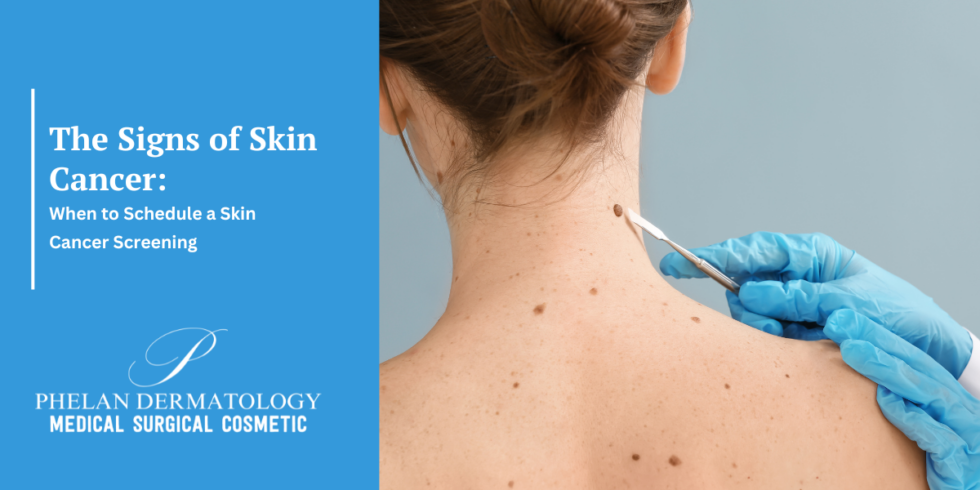 The Signs of Skin Cancer: When to Schedule a Skin Cancer Screening ...